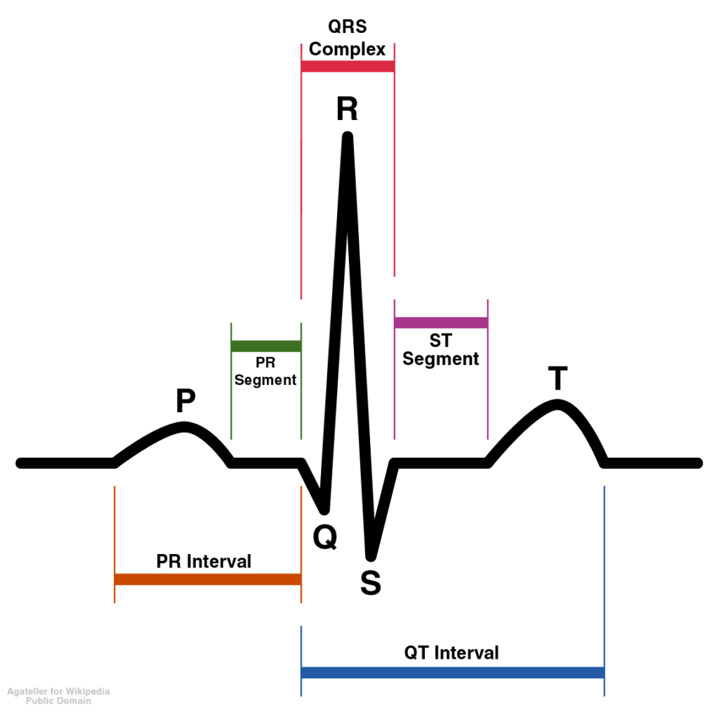 EKG Rhythms Interpretation. Best Practice Quiz Strips ACLS