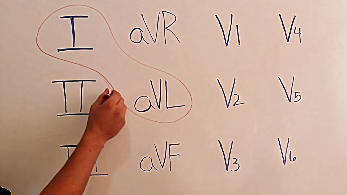 Lateral Leads of ekg | Nursing Pub